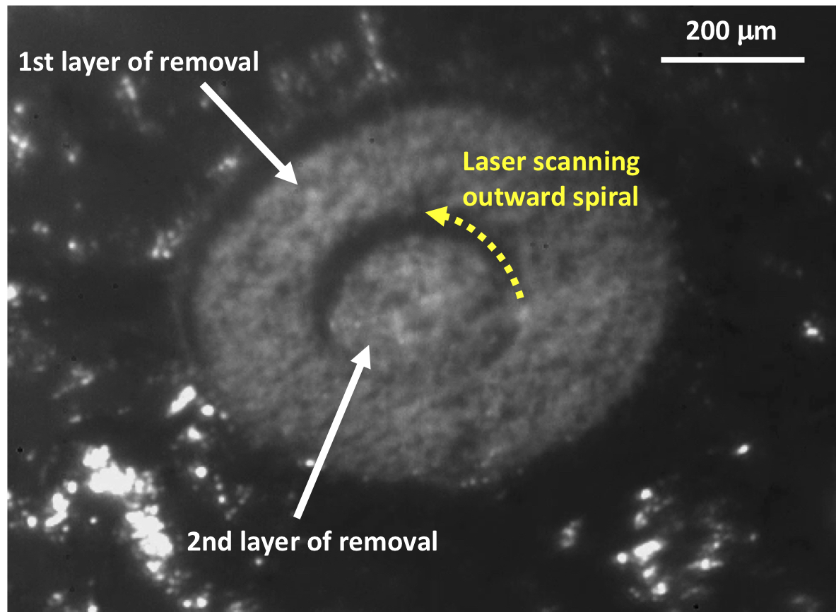 Surgical Applications – Applied Optics and Photonics